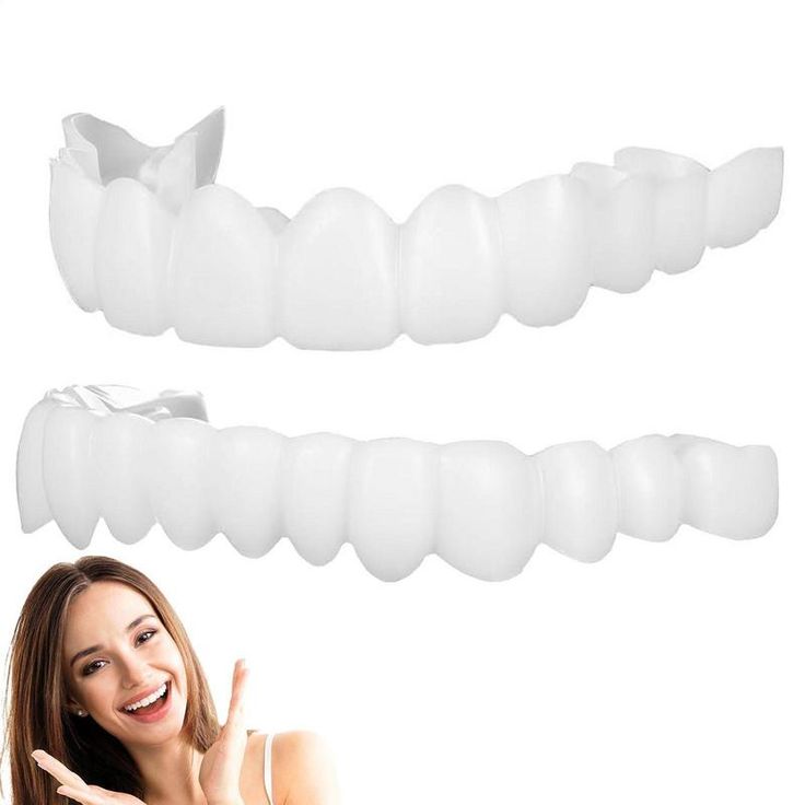 IMPORTED Snap-On Teeth Veneers – BlissfulBeding